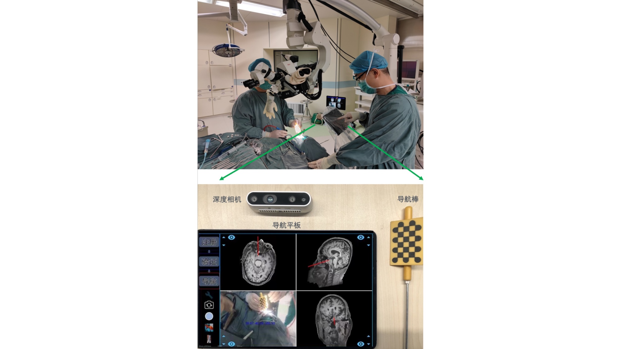 给手术配上GPS 北京协和医院与腾讯联合发布国产手术导航系统_央广网